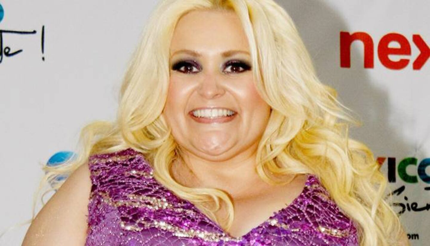 Así luce Sheyla Tadeo tras perder más de 50 kilos y donar piel para ...