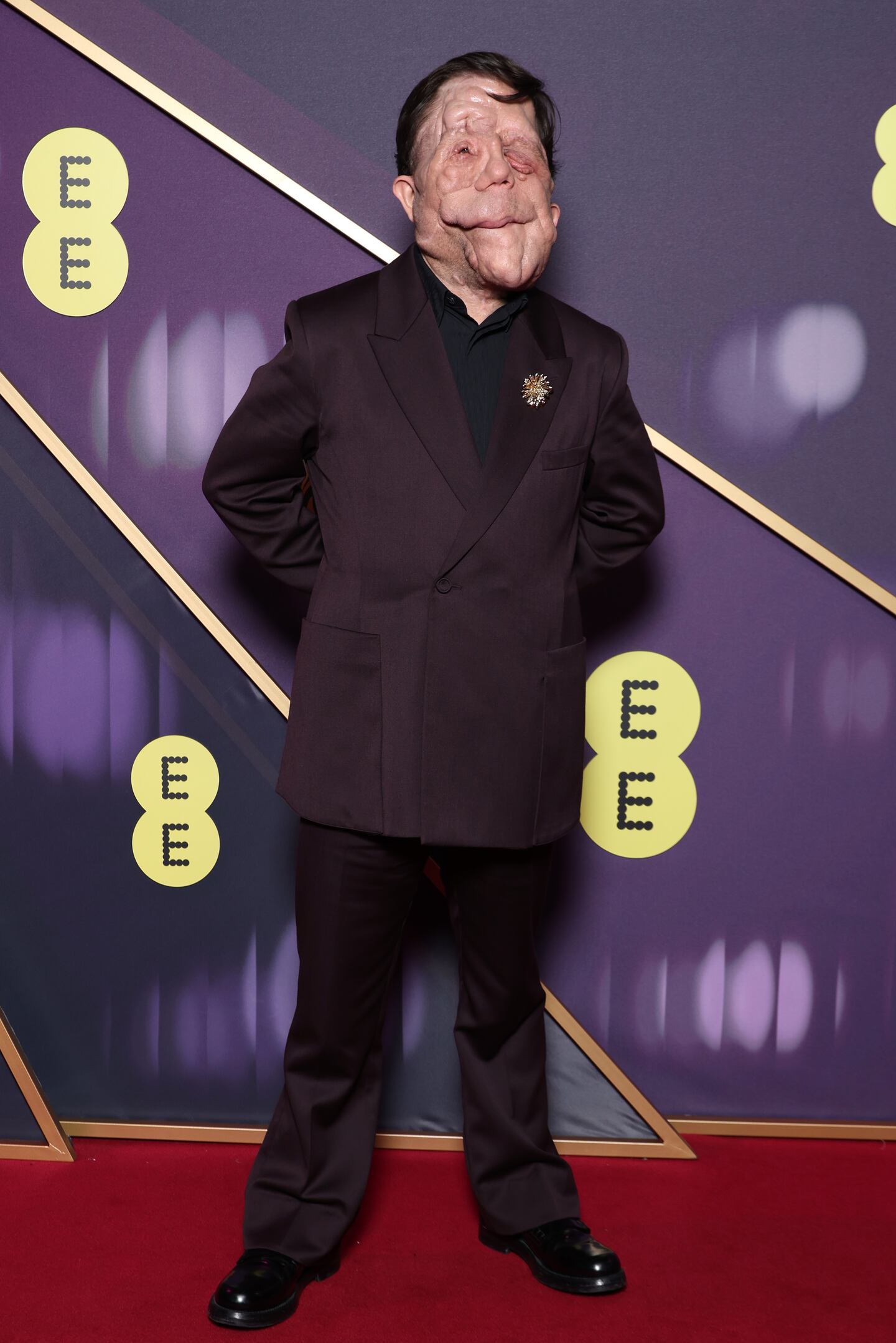 Adam Pearson: el actor que enfrenta el estigma social por su apariencia – Publimetro México