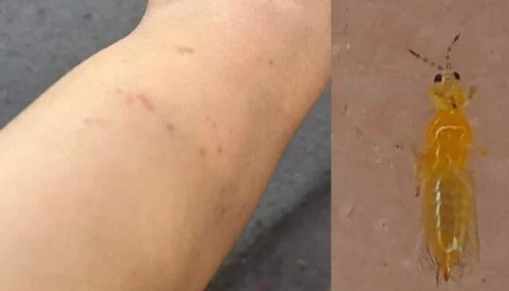 ¿Qué son los jejenes, insectos que invaden Monterrey? – Publimetro México